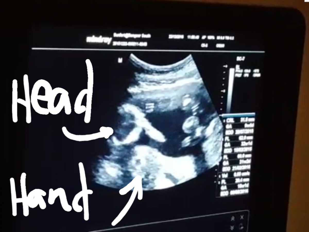 Meet our Little Baby | Mary Ann Tan